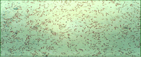 Cholera (Vibrio cholerae)