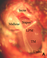 Columbia University Department of Otolaryngology: Fowler Memorial Laboratory
