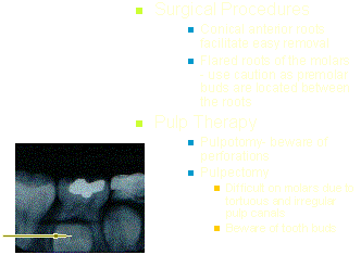 PowerPoint Presentation - Anatomy of Primary Teeth