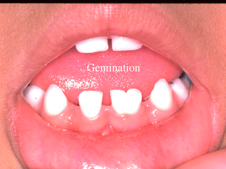 PowerPoint Presentation - Pediatric Oral Pathology