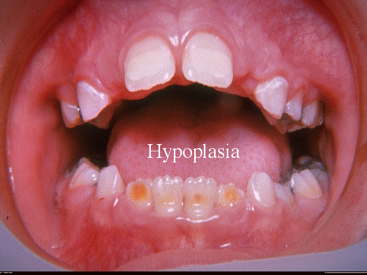 PowerPoint Presentation - Pediatric Oral Pathology