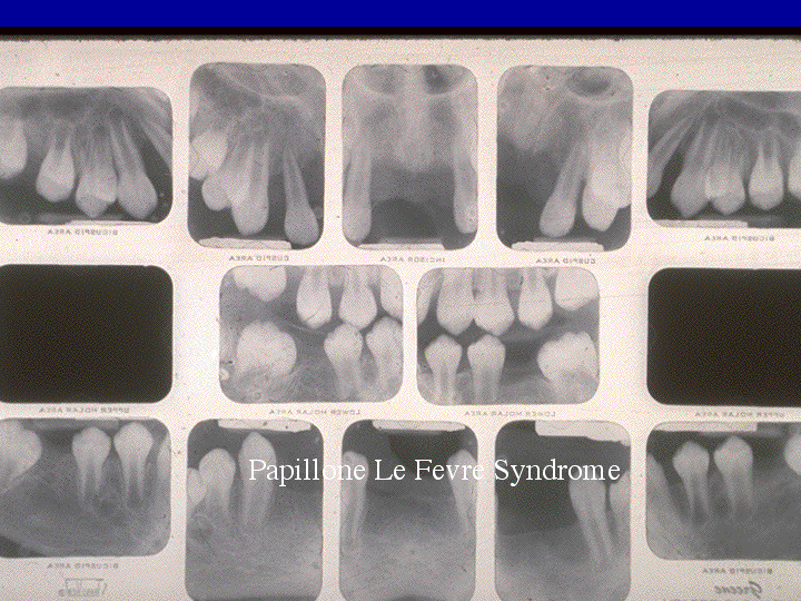 PowerPoint Presentation - Pediatric Oral Pathology