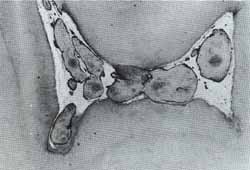 Endodontic Instruments and Their Uses