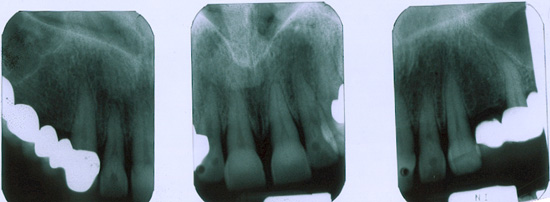 Index of Radiographs