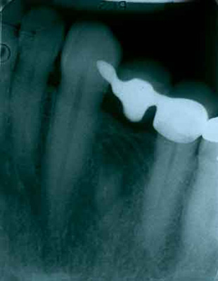 Periapical Radiology Exercise (March 2003)