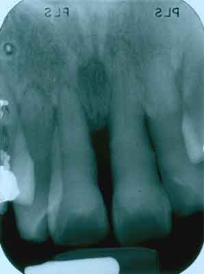 Periapical Radiology Exercise (March 2003)