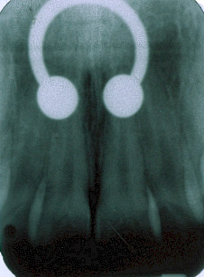 Index of Radiographs