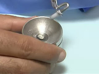 Class II Amalgam Restoration