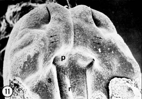 Facial and palatal development