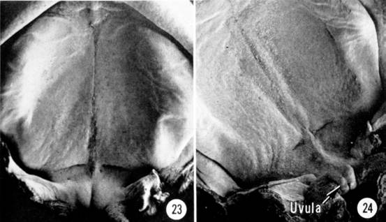 Facial and palatal development