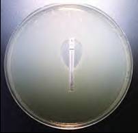 Introduction to Antimicrobial Therapy