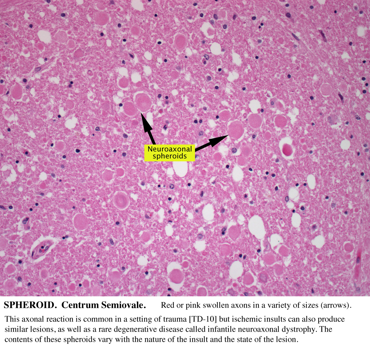 Neuropathology Atlas Update