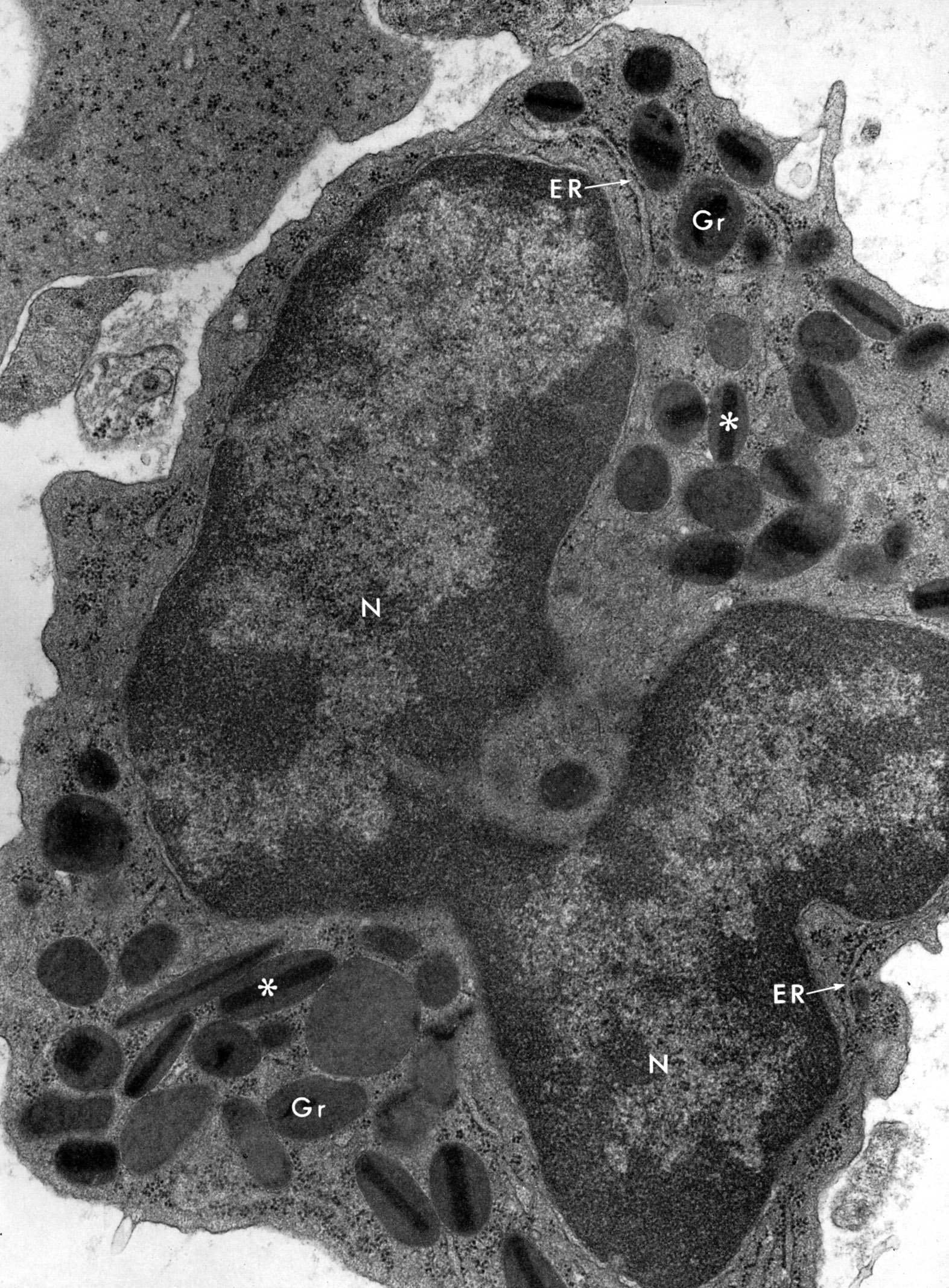 Lysosomes Electron Micrograph
