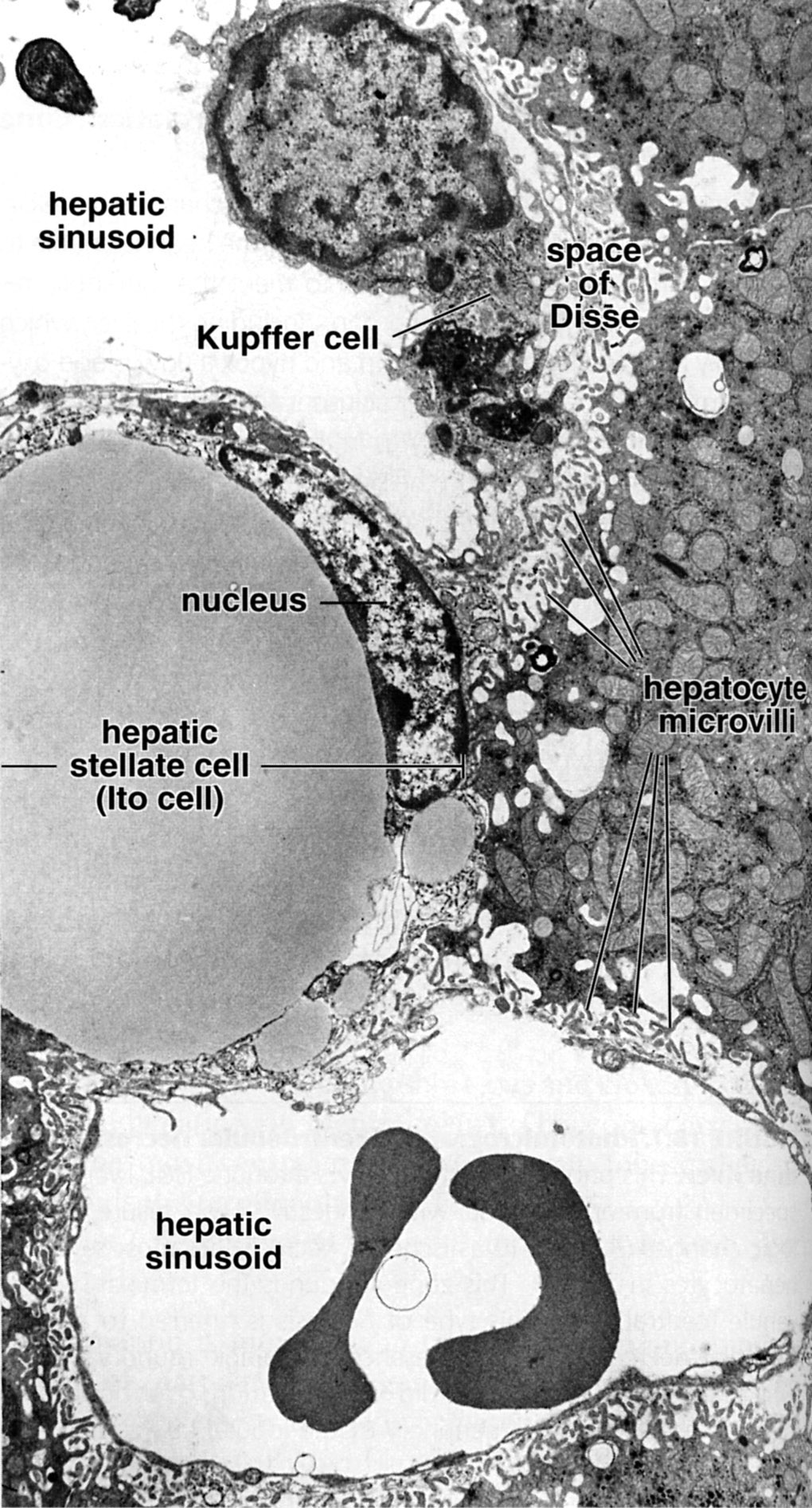 Liver Sinusoids