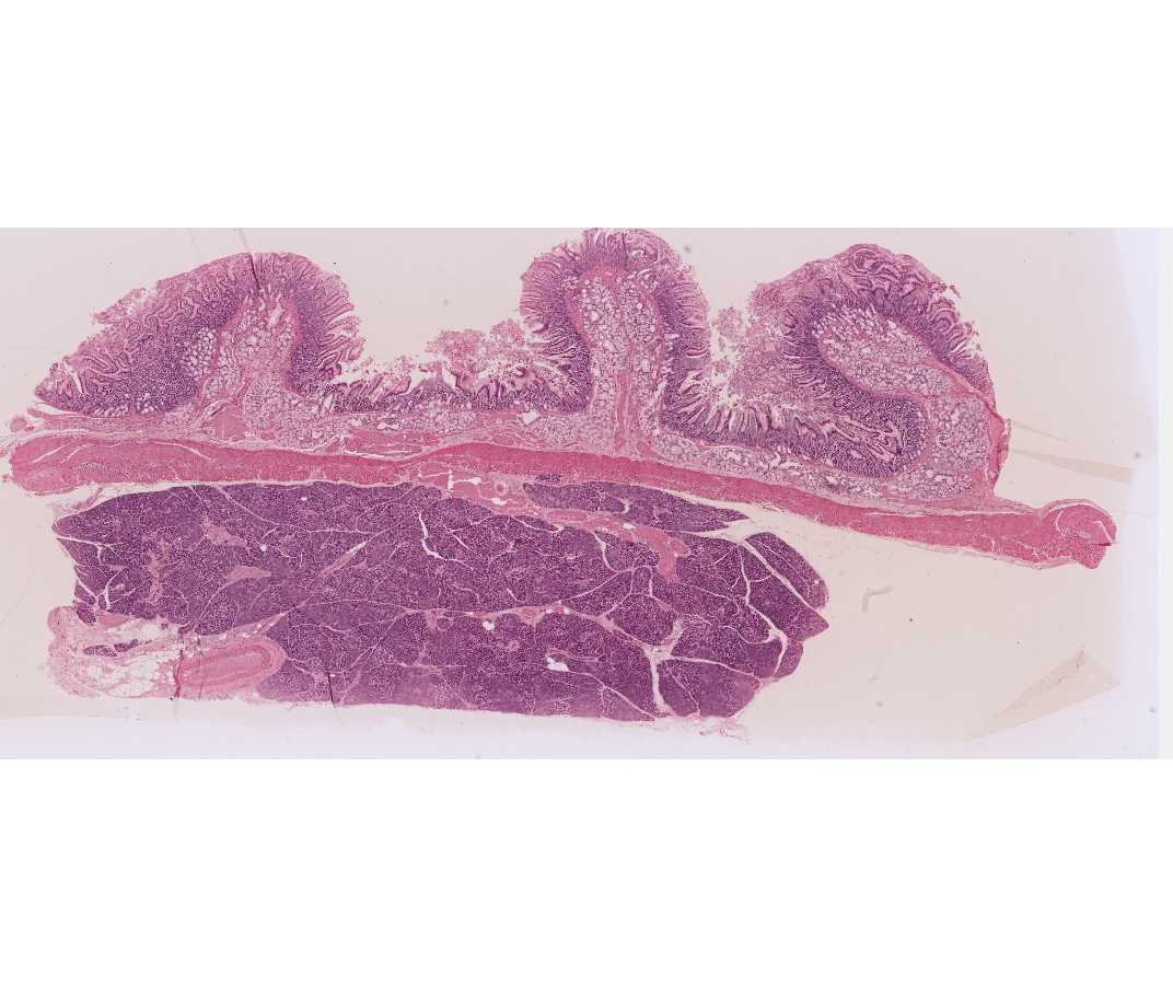Duodenum Slide Labeled