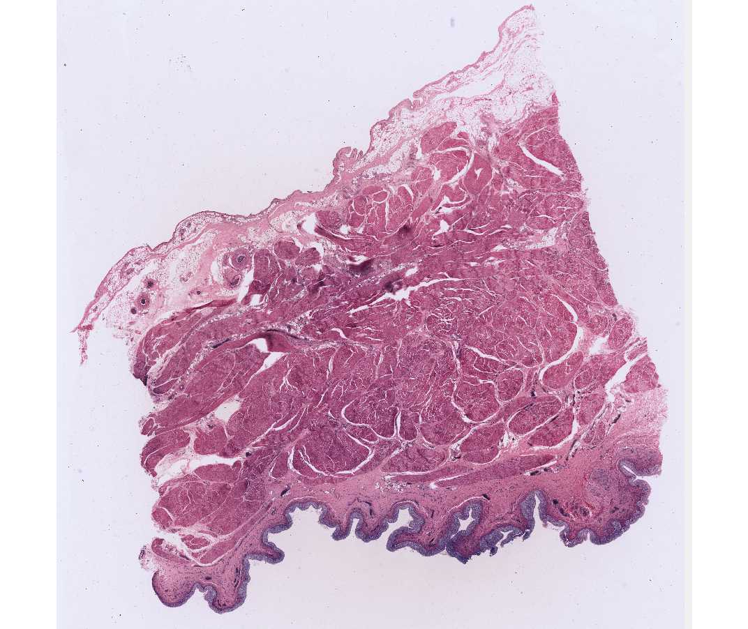 Transitional Epithelium Histology