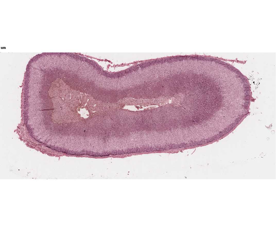 Chromaffin Cells Histology