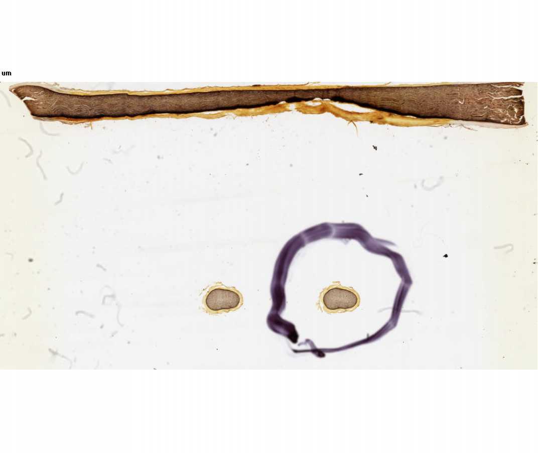 Nerve Longitudinal Section Slide