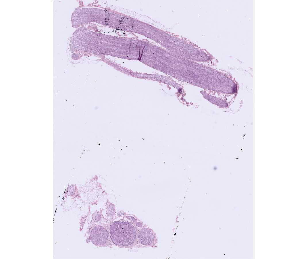 Nerve Cross Section Slide
