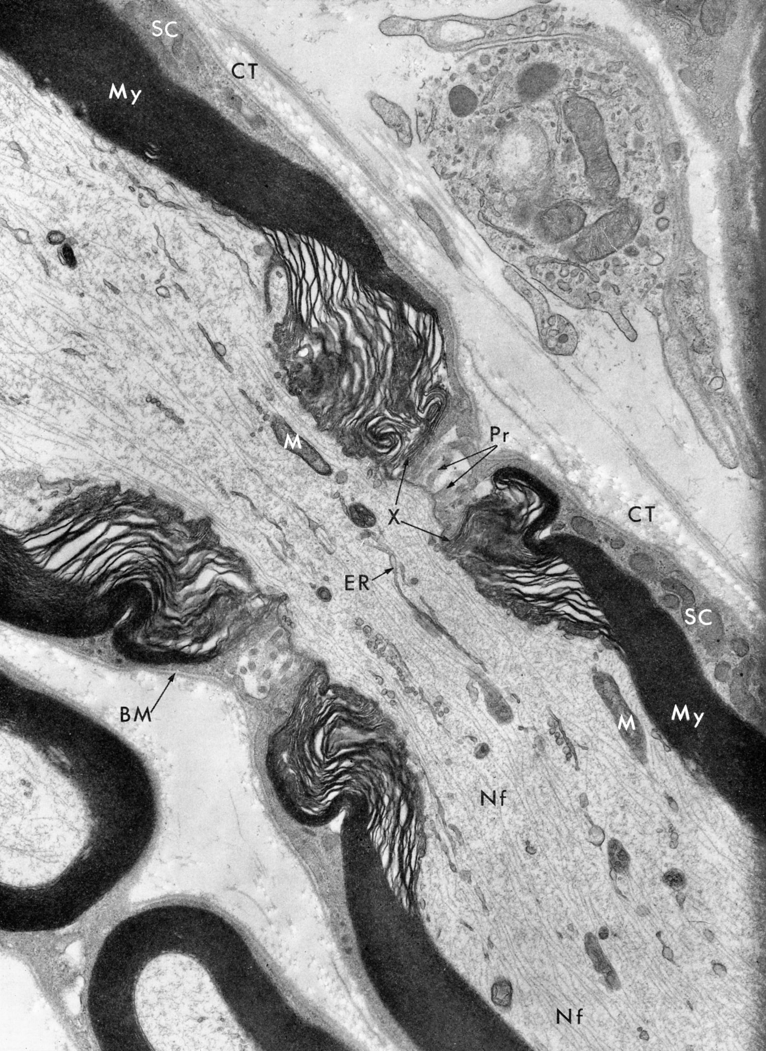 Nerve Cell Electron Microscope