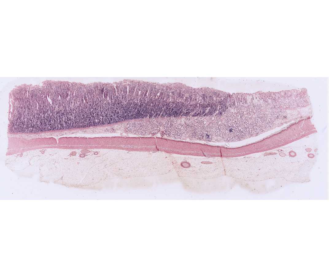 Human Duodenum Histology