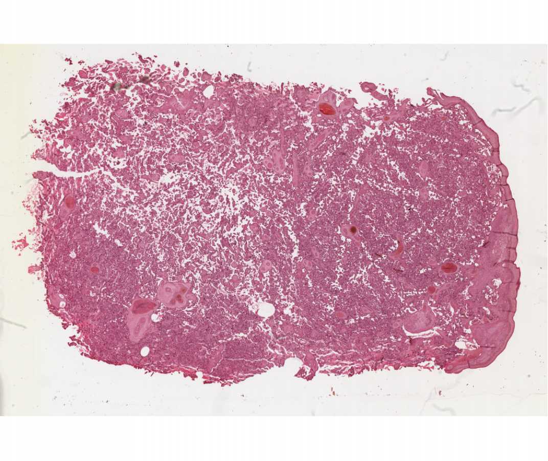 Placenta Histology