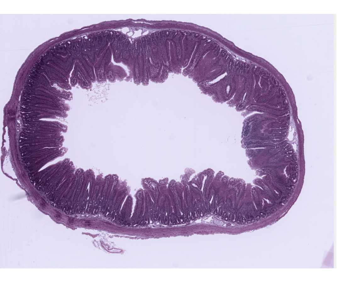 Human Duodenum Histology