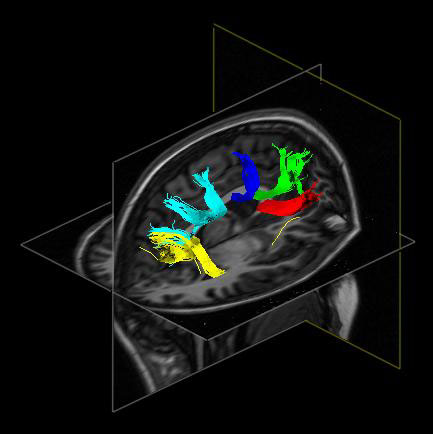 Maze for fMRI studies
