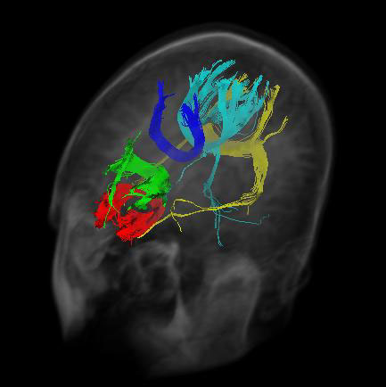 Maze for fMRI studies