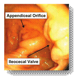 Tutorial on Current Standards for Screening Colonoscopy