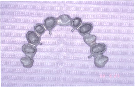 Figure 6: Another view of the metal casting. This is the inside of the ...