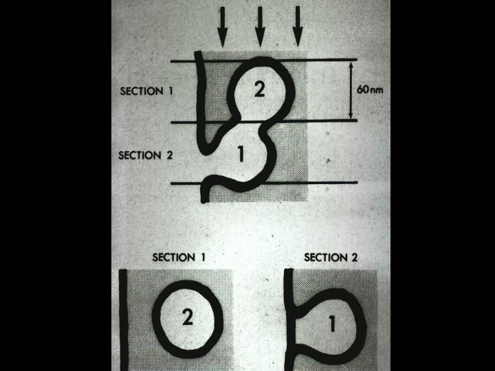 Serial sectioning EM suggests that free vesicles are conncected to ...
