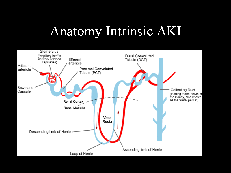 Anatomy Intrinsic AKI