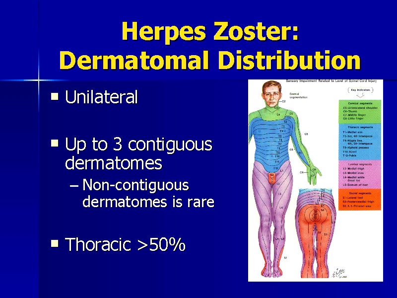 Herpes Zoster: Dermatomal Distribution