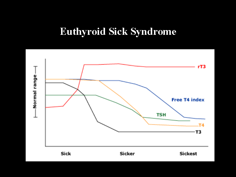 Euthyroid Sick Syndrome
